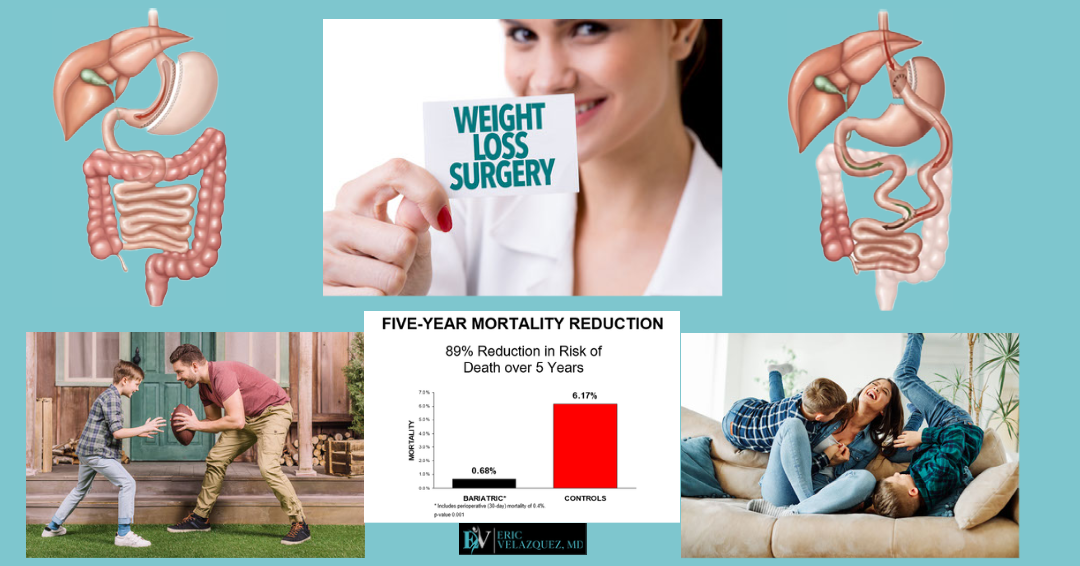Transforming Lives: The Life-Changing Benefits of Weight Loss Surgery ...